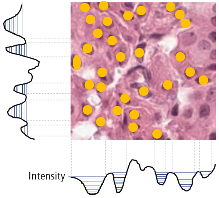Medical Image Segmentation - Region growing / Watershed algorithm